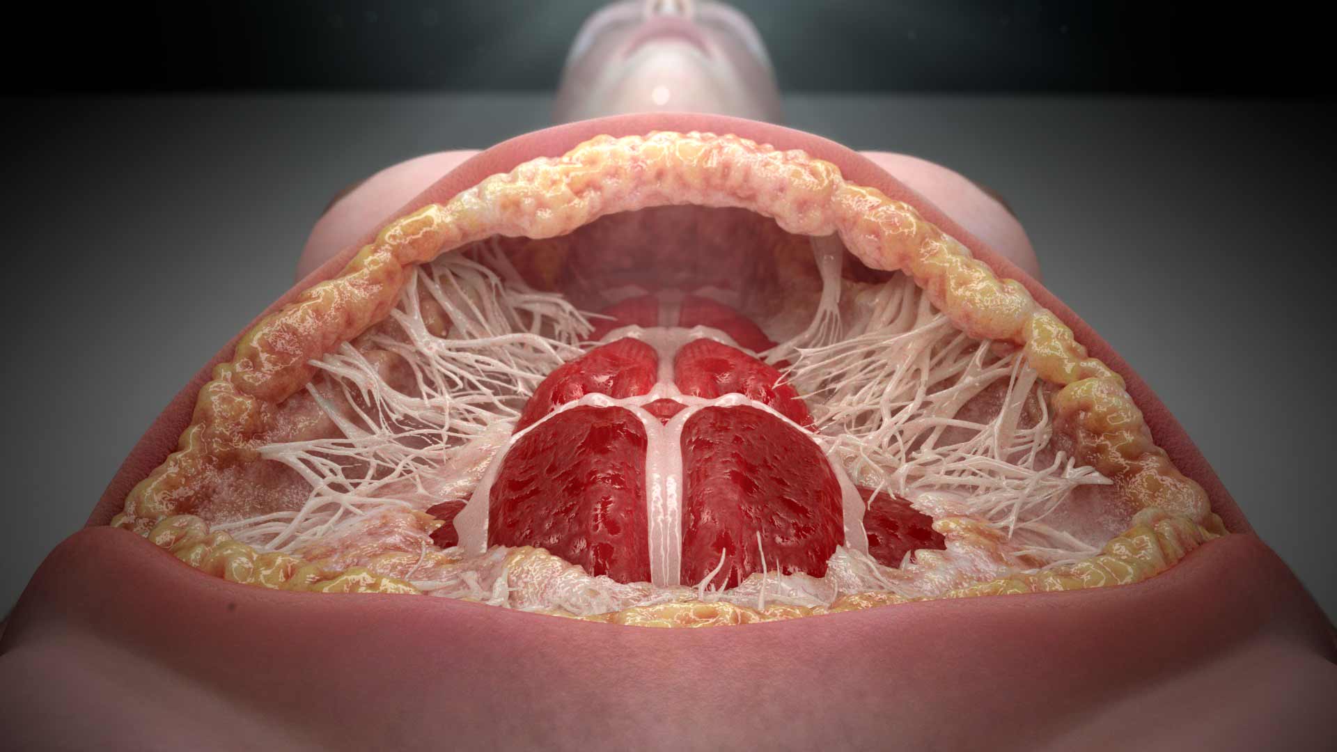 3D Surgery | Pixel Medical Animation